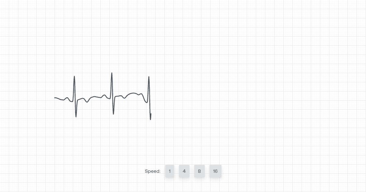 waveforms - Codesandbox