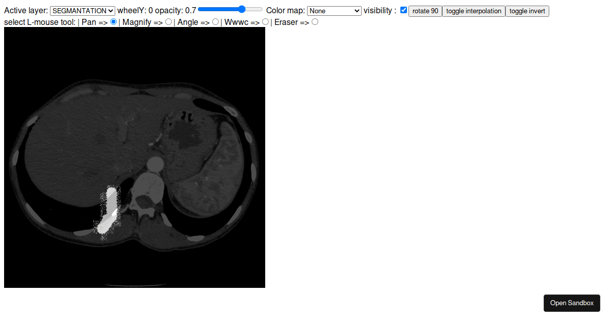Cornerstone React Example (forked) - Codesandbox