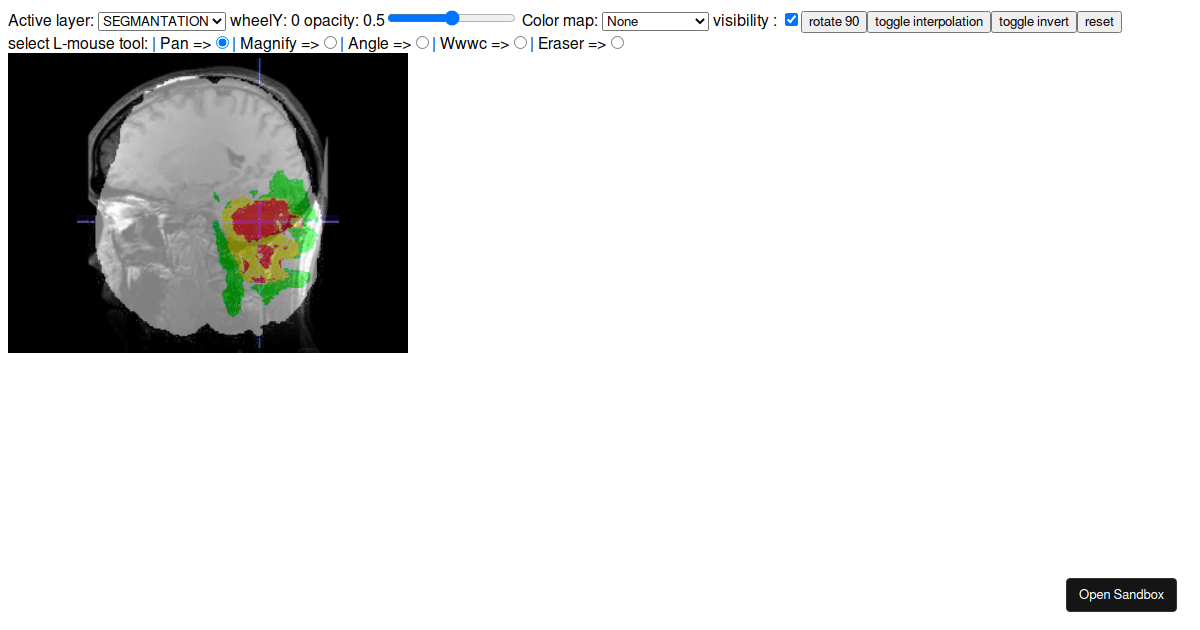 Cornerstone React Example Forked Codesandbox
