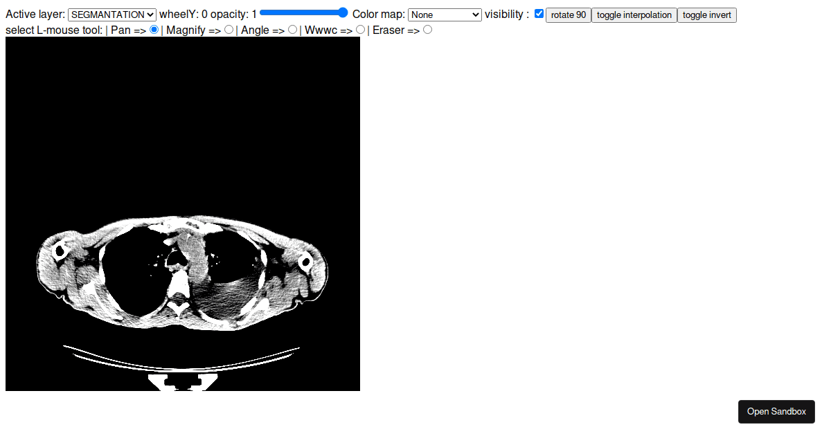 Cornerstone React Example (forked) - Codesandbox