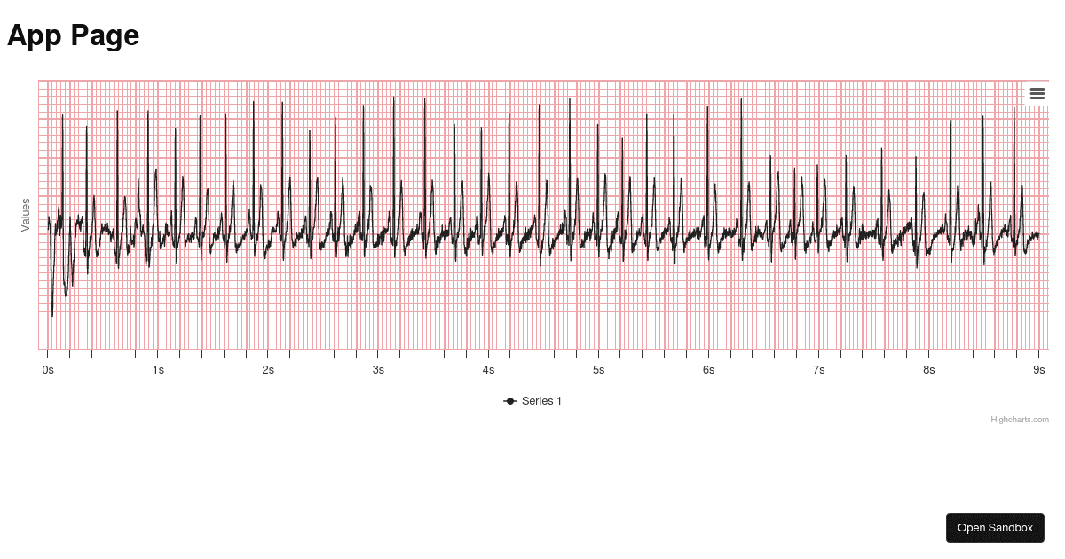 ECG Chart - Codesandbox
