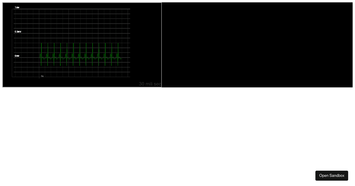 ECG live chart - d3 (forked) - Codesandbox