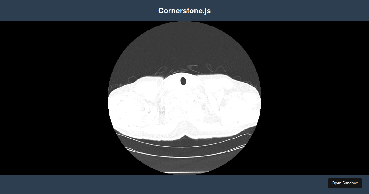 CornerstoneJS: Simple Example (forked) - Codesandbox