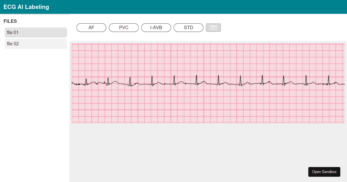 ECG AI Labeling2 - Codesandbox