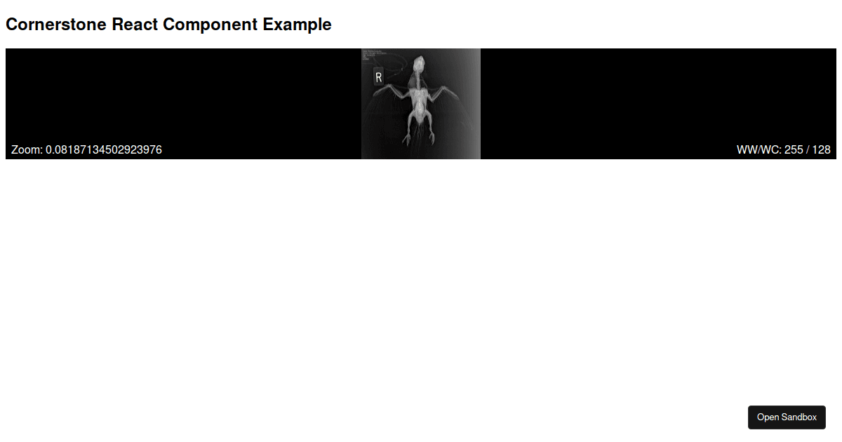 Cornerstone React Component Example - Codesandbox